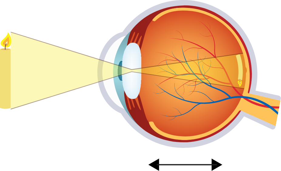 Myopia Management | Osmond Drake Opticians