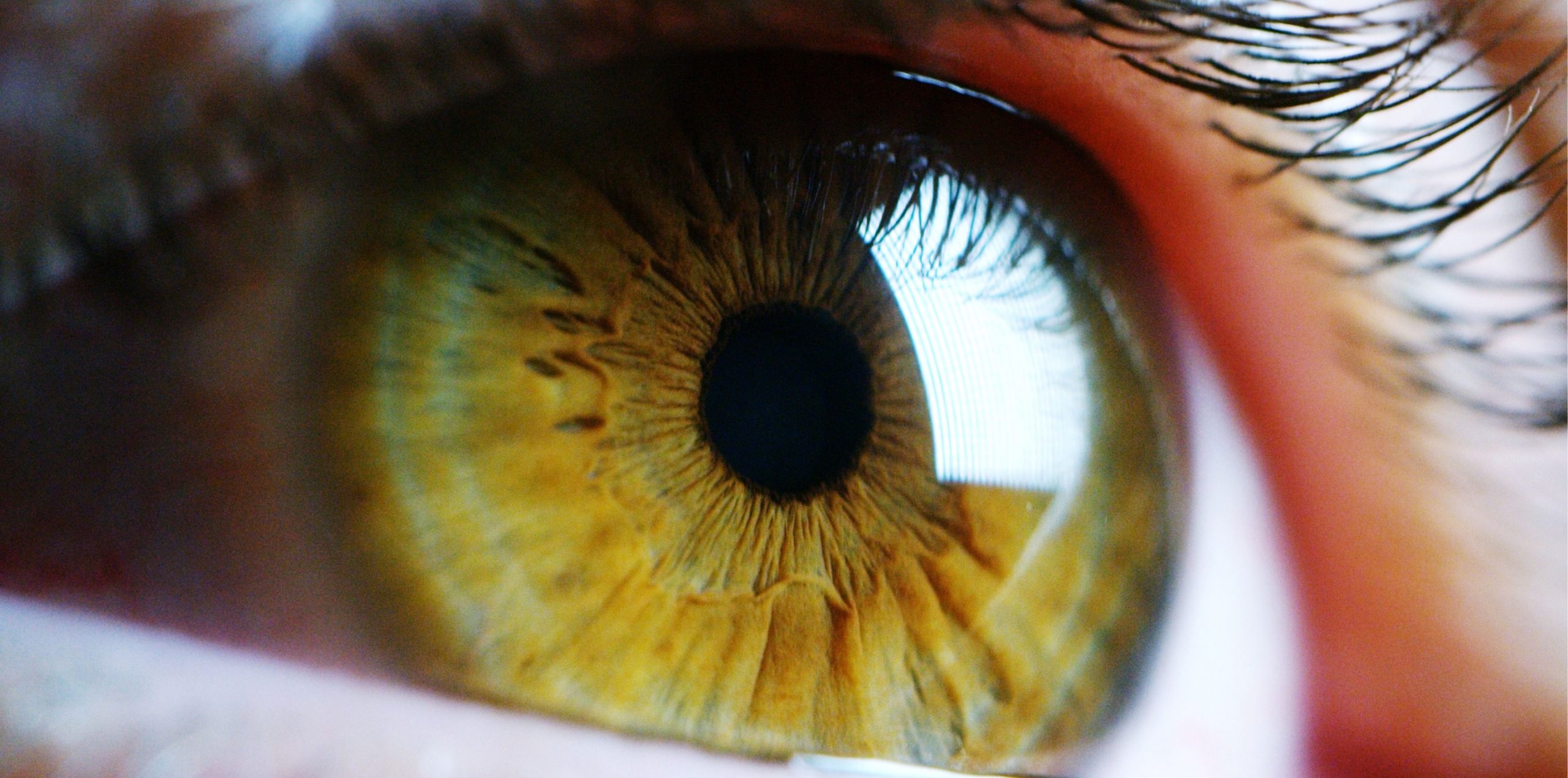 Dry Eye | Osmond Drake Opticians